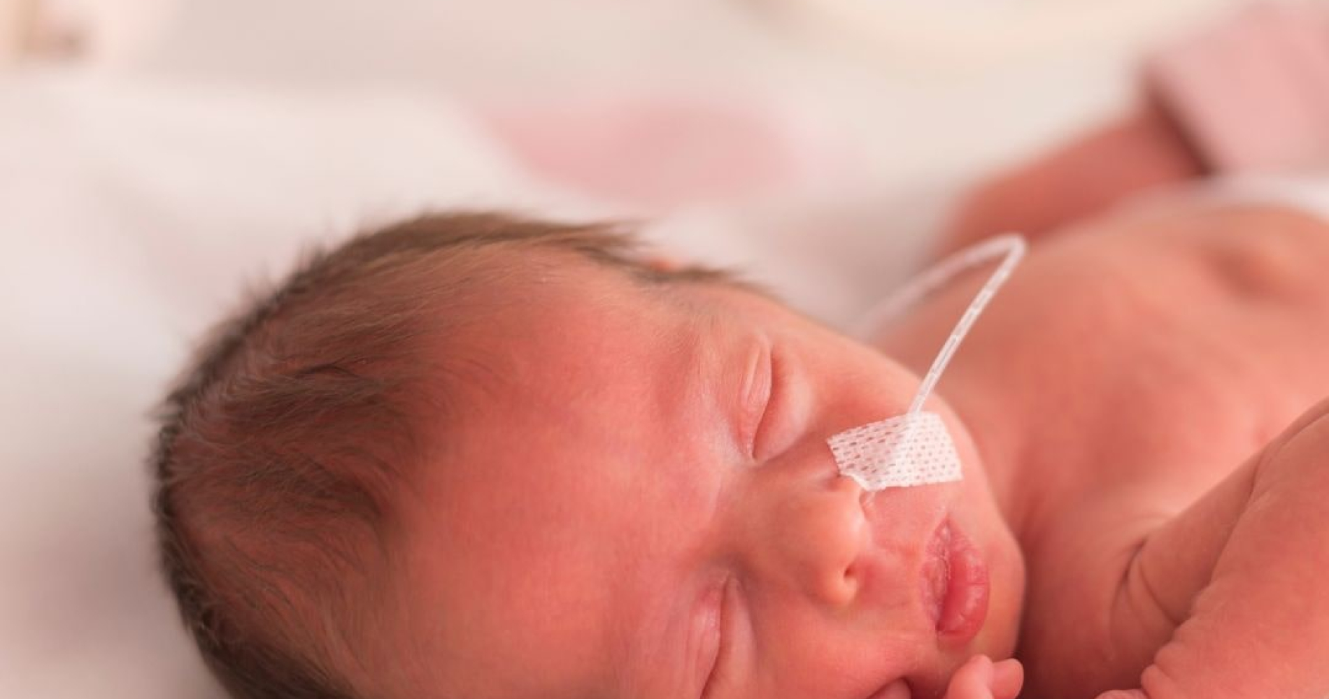 A ventilation mask for premature babies | Vygon