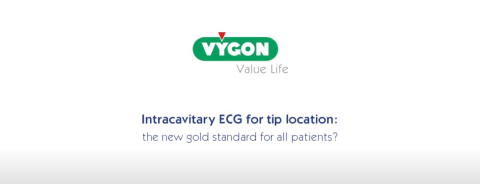 ECG for tip location: the new gold standard for all patients ? | Vygon