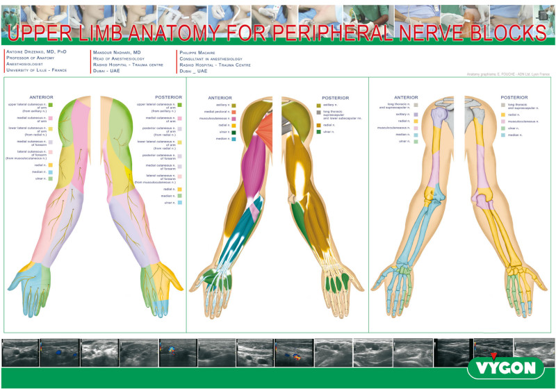 Locoplex - Plexus and peripheral nerve blocks: Needles | Vygon