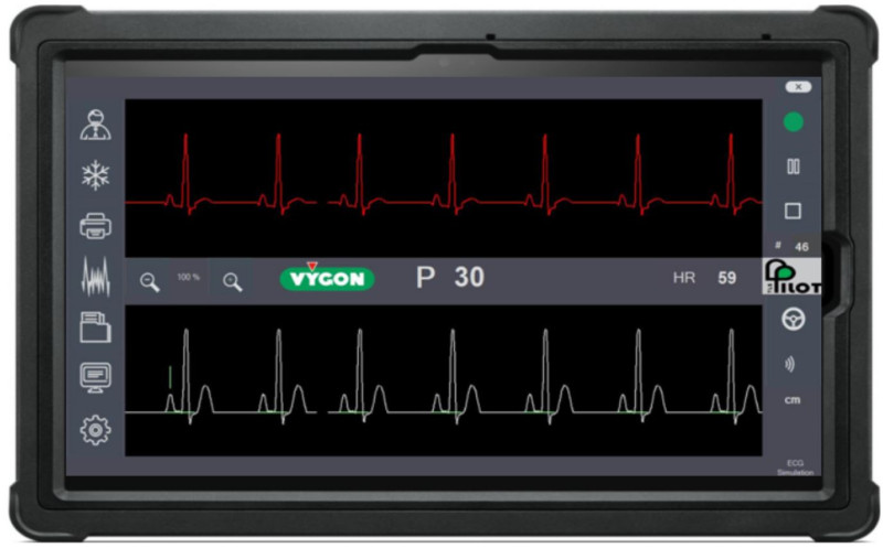PILOT TLS - ECG tip location system | Vygon
